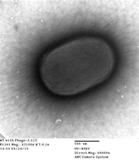 Why It Is Not Clear Background After Treated Bacteria With Phage In Tem