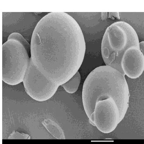 Particle Size Distribution Of Drug Loaded Eudragit Rs 100 Microsponges Download Scientific