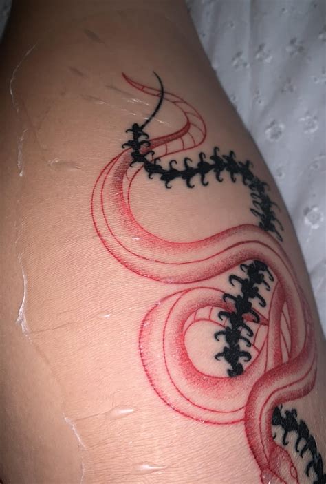 Put On A New Layer Of Saniderm Did I Do It Good Enough For It To Work