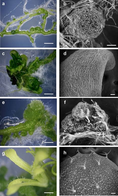 Plant Regeneration Of Root Explants After Moving Them To Hormone Free