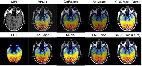Cddfuse Correlation Driven Dual Branch Feature Decomposition For Multi Modality Image Fusion