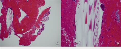 A Hande Staining Of Longitudinal Section Of Nail Unit Low Power View Download Scientific
