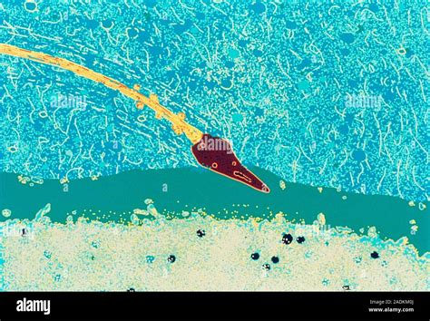 False Colour Transmission Electron Micrograph Tem Of An Egg Ovum During Fertilisation