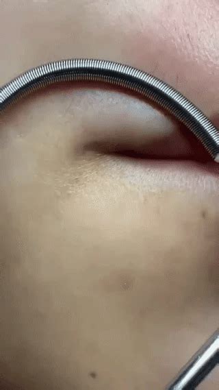 Facial Hair Remover Glizm