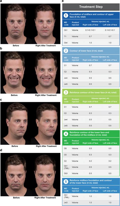 Md Codes™ A Methodological Approach To Facial Aesthetic Treatment With