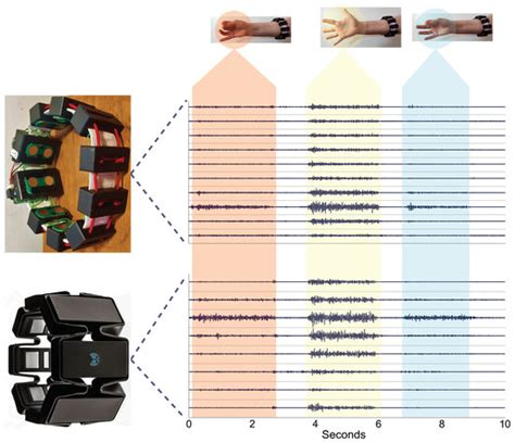 Sensors Special Issue Emg Sensors And Applications