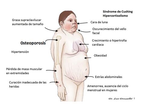 Sx De Cushing Puzzle Online