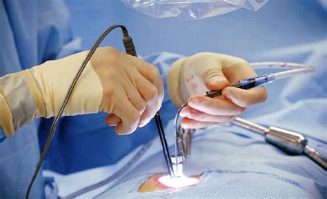 Understanding Important Aspects Of Minimally Invasive Spine Surgery