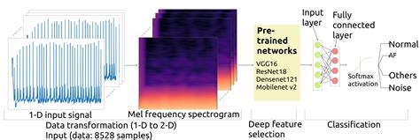 Deep Spectral Features To Detect Atrial Fibrillation Using Single Lead Ecg Signals