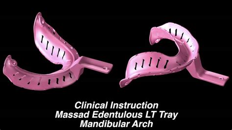 Massad Impression Trays At Gladys Davy Blog