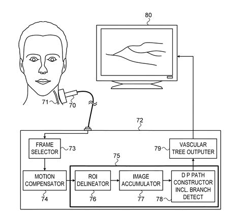 Quantitative Assessment Of Neovascularization Eureka Patsnap