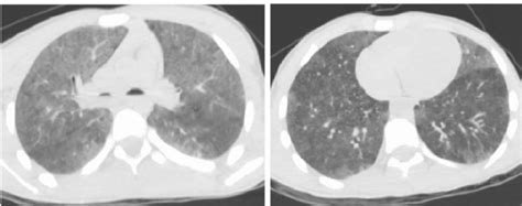 Air Fluid Level In Main Download Scientific Diagram
