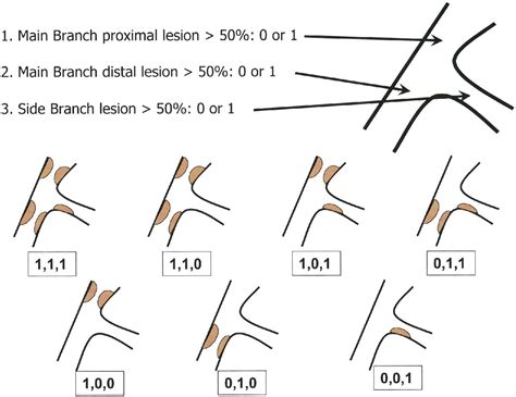 Bifurcation Lesions The Cardiology Advisor Cardiology Diagnostic