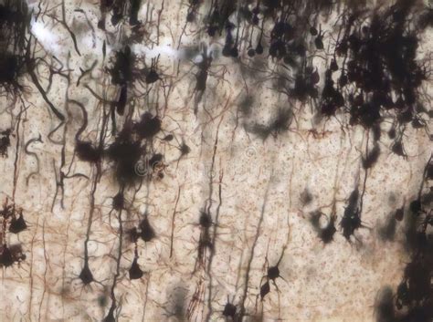 Golgi Stain Brain Stock Image Image Of Microscopy 327438693