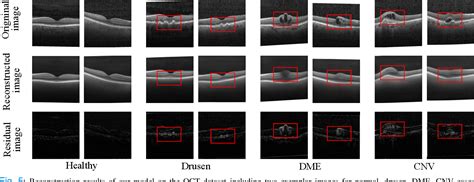Figure 5 From Anomaly Detection For Medical Images Using Self