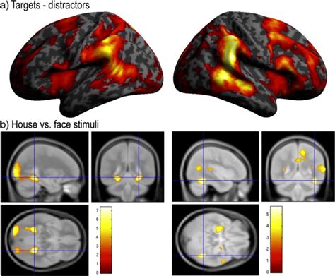a voxelwise whole brain analysis contrasting targets minus