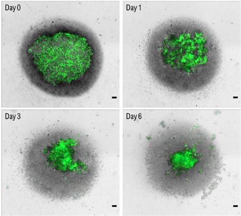 15 Monitoring Of Recovered A549 Cells Celltracked In Green Download Scientific Diagram