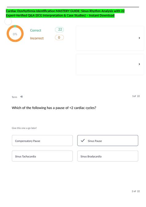 Cardiac Dysrhythmia Identification Mastery Guide Sinus Rhythm Analysis
