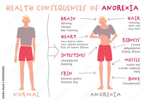 Anorexia Nervosa Tumblr Zitate