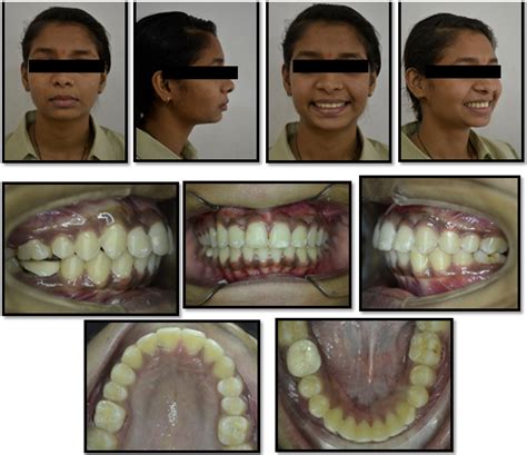 Post Treatment Photographs Download Scientific Diagram