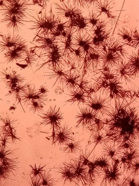 858 Questions With Answers In Mtt Assay Scientific Method