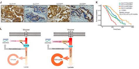 项目文章 Cell子刊（if 14 3） 分子细胞卓越中心高栋及合作团队利用代谢分型发现化疗耐药胰腺癌治疗新靶点