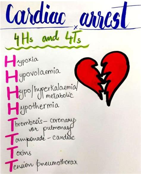 Cardiac Arrest Causes 4hs And 4ts Diagnosis And Emergency Management