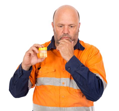 Dot Urine Drug Testing Mfp Work Wellness