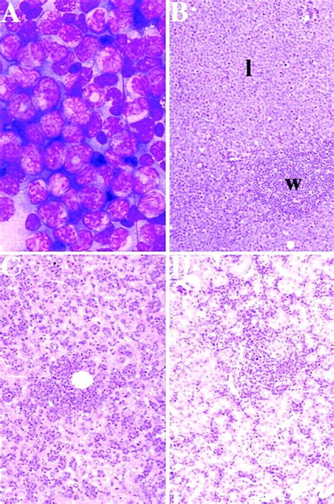 Leukemic Transformation Is Characterized By Dissemination Of Immature