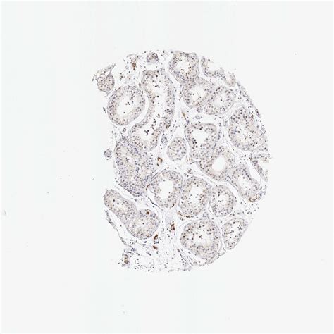 Tissue Expression Of Casp3 Staining In Testis The Human Protein Atlas