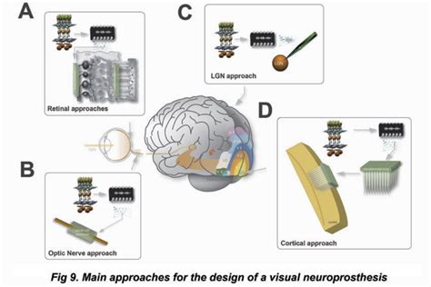 Introduction To Visual Prostheses By Eduardo Fernandez And Richard Normann Webvision