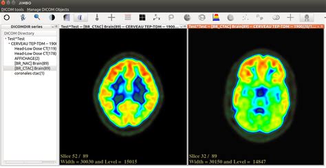 coloring tool · issue 175 · cornerstonejs cornerstonetools · github