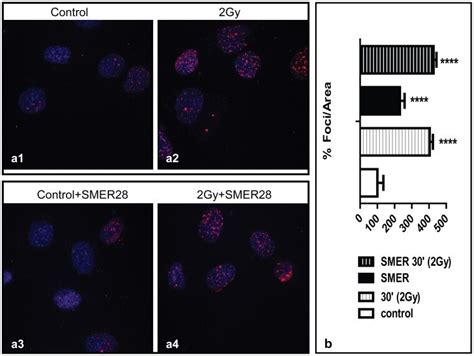 Computerized Calculation Of γh2ax Foci In The Nuclei Of Cells