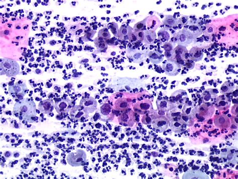 Cytopathology Of The Uterine Cervix Digital Atlas