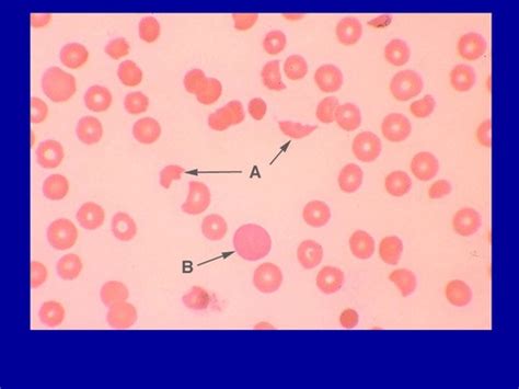 Hematology Platelet Study Guide Flashcards Quizlet