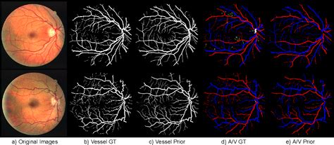 Figure 2 From Fully Automated Tree Topology Estimation And Artery Vein Classification Semantic