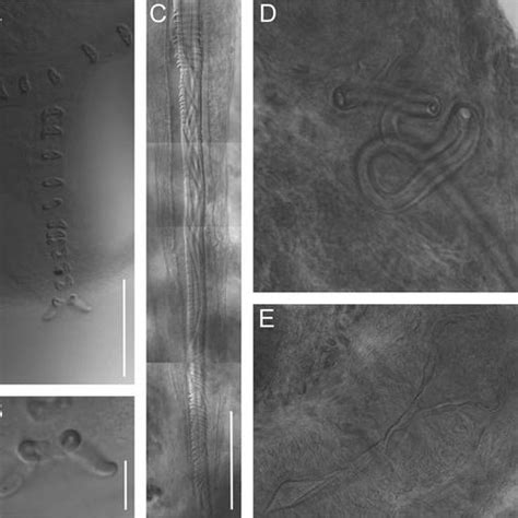 Measurements Of Monogeneans Download Scientific Diagram