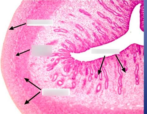 Endometrium Slide Lawrence Hsu Lin On X 📸 Snapshot Of Endometrial