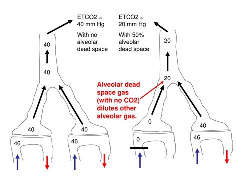 Ppt Why Is Hypoxemia More Common Than Hypercarbia Powerpoint Presentation Id 1999837
