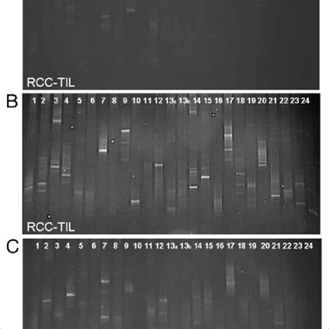 Comparative Tcr Clonotype Mapping Reveals Common T Cell Clones In The Download Scientific
