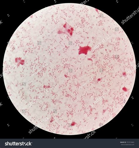Gram Negative Bacilli 100x Gram Negative Bacilli 100x
