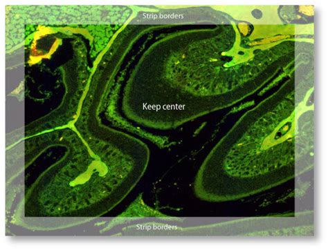 To Aid Image Processing For Pixel Precise Alignment Images Are Download Scientific Diagram