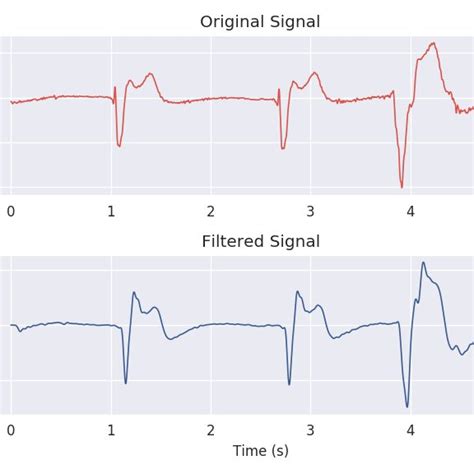 Signal Preprocessing And Filtering Step This Process Removes Most