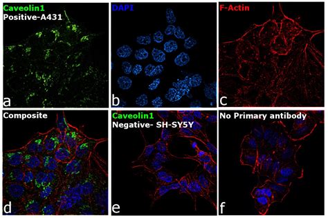Caveolin 1 Antibody Ma5 16329