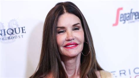 Janice Dickinsons Disfigured Face Revealed In Never Before Seen Photos
