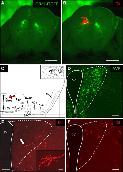 Dii Labeling In The Paraventricular Nucleus Of The Hypothalamus After Download Scientific