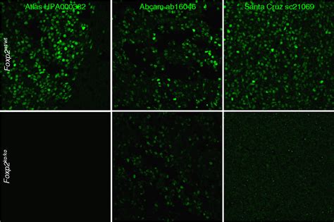Figure 1 From Humanized Foxp2 Specifically Affects Cortico Basal