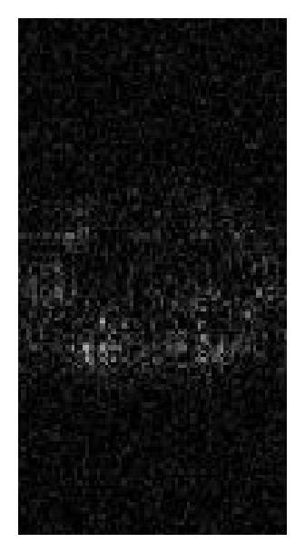 Results Of Multi Image Reordering Method On Dynamic Phantom Data Image