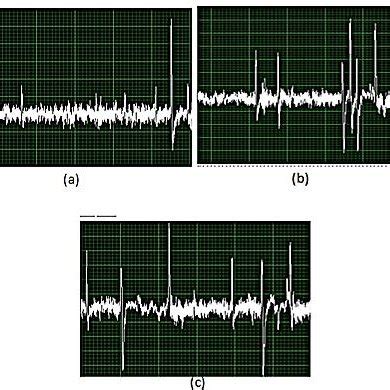 EEG Simulator Module Arduino BT And Lilypad Microcontroller With Download Scientific Diagram