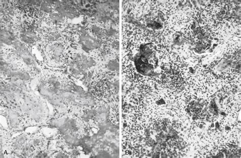 Malignant Bone Tumors Clinical Tree